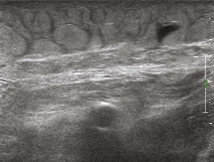 Skin and Subcutaneous Tissue | Radiology Key