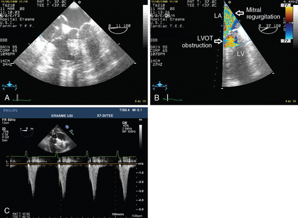 Perioperative sonographic monitoring in cardiovascular surgery ...