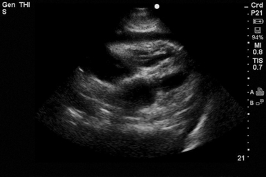 The extended fast protocol | Radiology Key