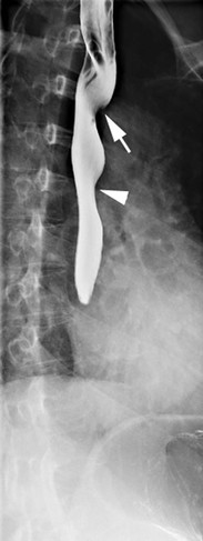 The Stomach | Radiology Key