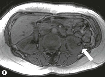 The Urinary Tract | Radiology Key