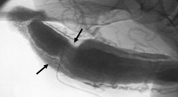 Male Genitourinary Tract | Radiology Key