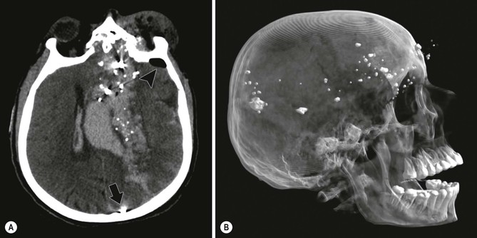 Overview of Anatomy, Pathology and Techniques; Aspects Related to ...