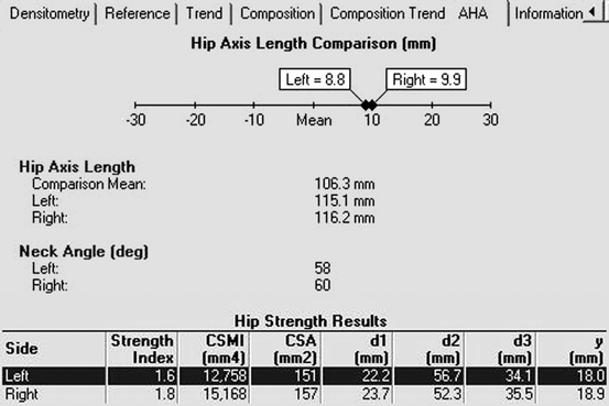 VFA Imaging, Femoral Morphometry, and Hip Structural Analysis ...