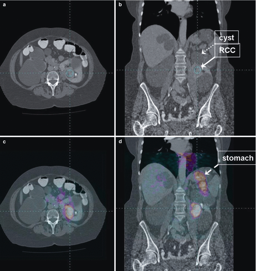 Medicine | Radiology Key