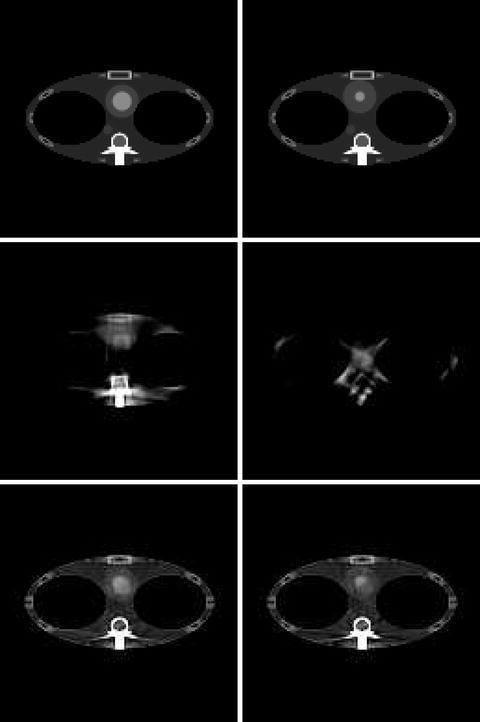 Radiographic Artifacts | Radiology Key
