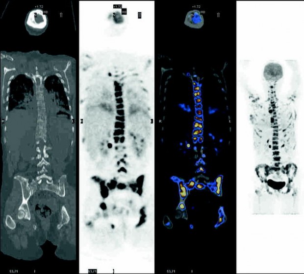 Metabolic | Radiology Key