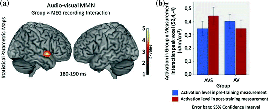 Studies on Music | Radiology Key