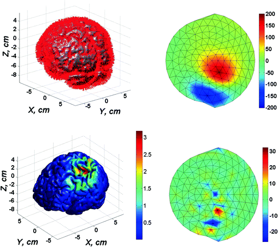 and Magnetic Fields of the Brain | Radiology Key