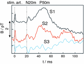 Magnetometers for MEG | Radiology Key