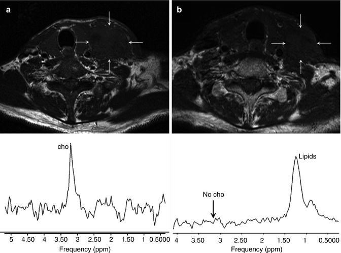 Overview of Functional MR, CT, and US Imaging Techniques in Clinical ...