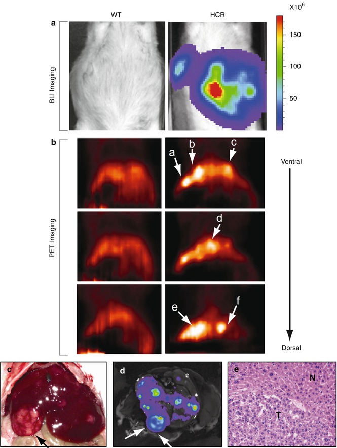 Cancer Biology: What’s Important for Imaging | Radiology Key