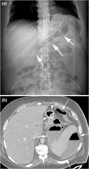 Soft Tissue Foreign Bodies | Radiology Key
