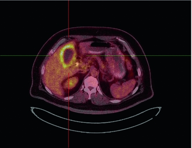 Imaging | Radiology Key