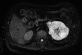 Functional CT and MRI of the Urinary System and Adrenal Glands ...