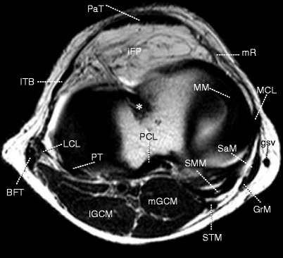 Anatomy of the Knee | Radiology Key