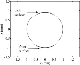 Imaging with Phased Arrays—An Introduction | Radiology Key