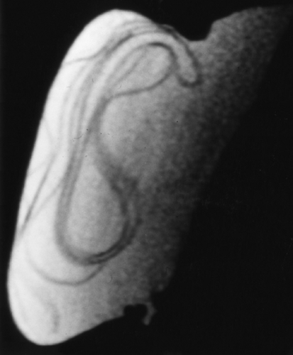 The Superficial Soft Tissues | Radiology Key