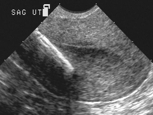 Obstetric and Gynecologic Imaging | Radiology Key
