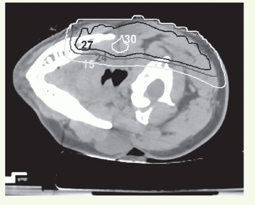 Skin | Radiology Key