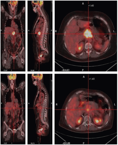 Molecular Imaging | Radiology Key