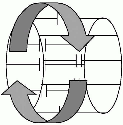 Magnet Design | Radiology Key