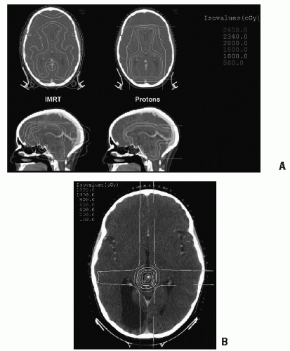 Supratentorial Brain Tumors | Radiology Key