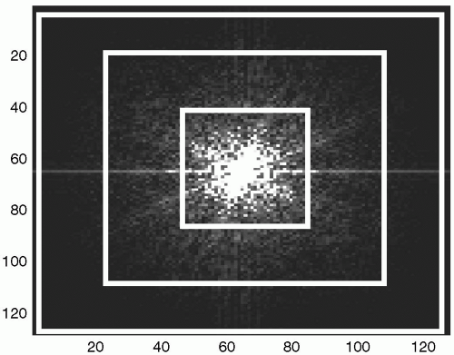 K-Space Revisited: An Informal View | Radiology Key