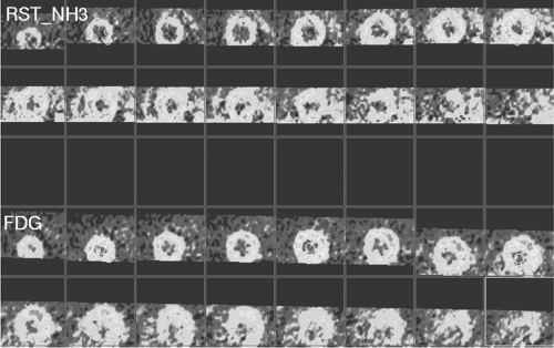 PET Viability Studies | Radiology Key