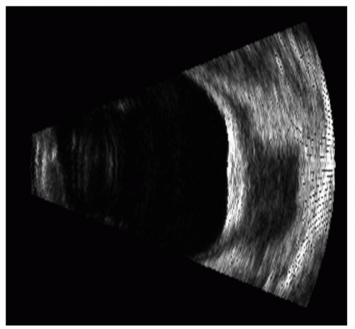 Orbital Diagnosis | Radiology Key