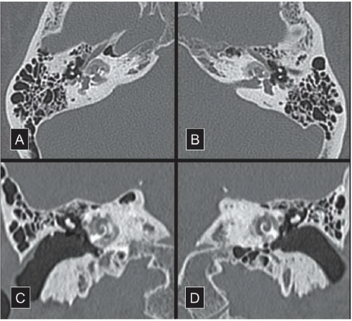 Neuroradiology: Head and Neck | Radiology Key