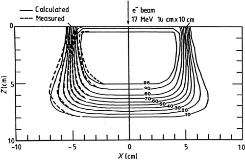 Electron Beam Therapy | Radiology Key