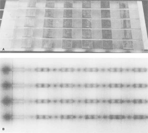 Quality Assurance | Radiology Key