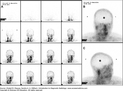 Introduction to Nuclear Medicine | Radiology Key