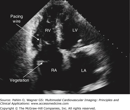 Echocardiography | Radiology Key