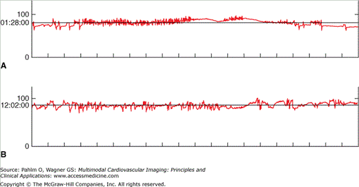 Graphical Analysis of Heart Rate Patterns to Assess Cardiac Autonomic ...