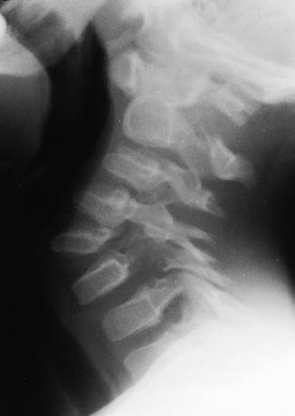 Anomalies | Radiology Key