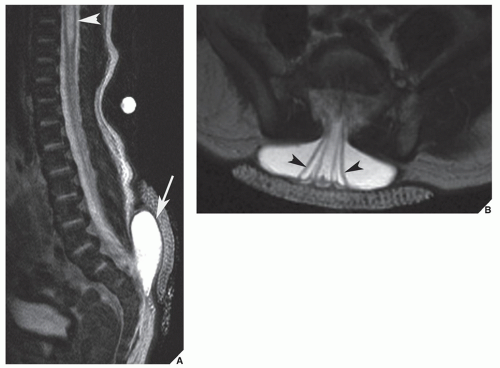 Radiologic Evaluation of Skeletal Anomalies | Radiology Key