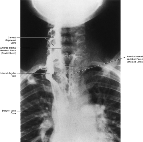 Veins of the Spinal Cord and Spine | Radiology Key