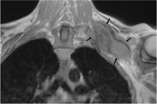 Shoulder/Arm | Radiology Key