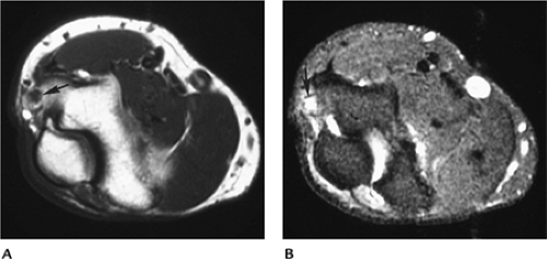 Elbow/Forearm | Radiology Key