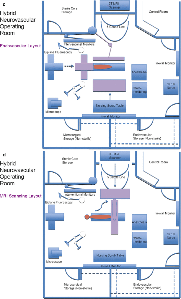 The Hybrid Neurovascular Operating Room | Radiology Key