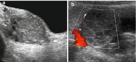 Ultrasound of the Urogenital Tract | Radiology Key