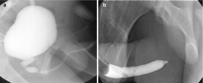 Urethral Imaging | Radiology Key