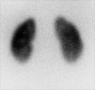Renal Imaging: Congenital Anomalies of the Kidney and Urinary Tract ...