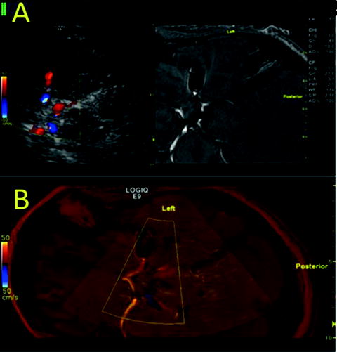 Image Fusion Technology | Radiology Key