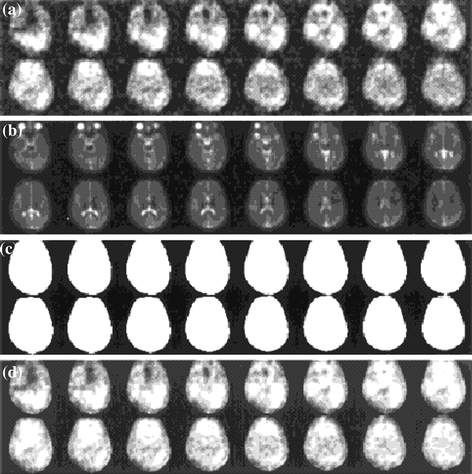 Summary and Discussion | Radiology Key