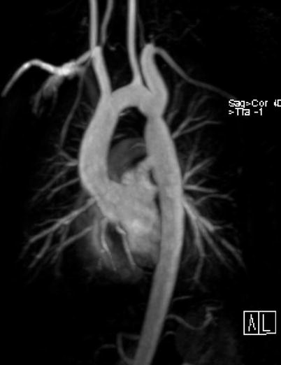 Pediatric Cardiac Imaging I: CT and MR Techniques | Radiology Key