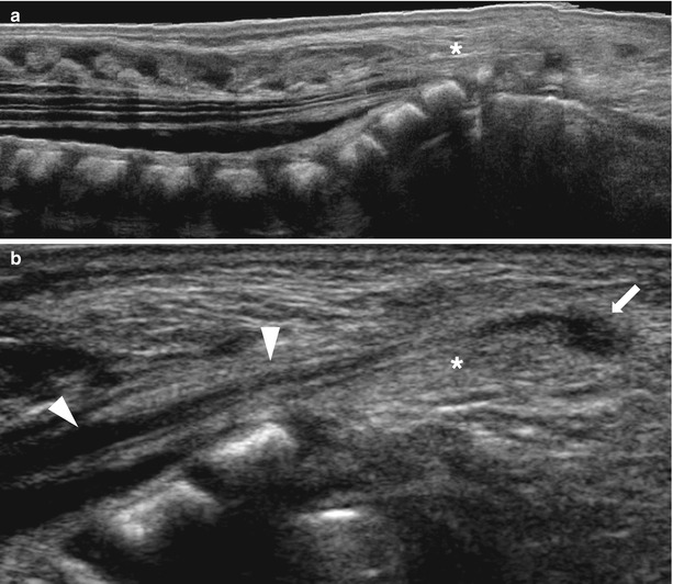 Neurosonography | Radiology Key