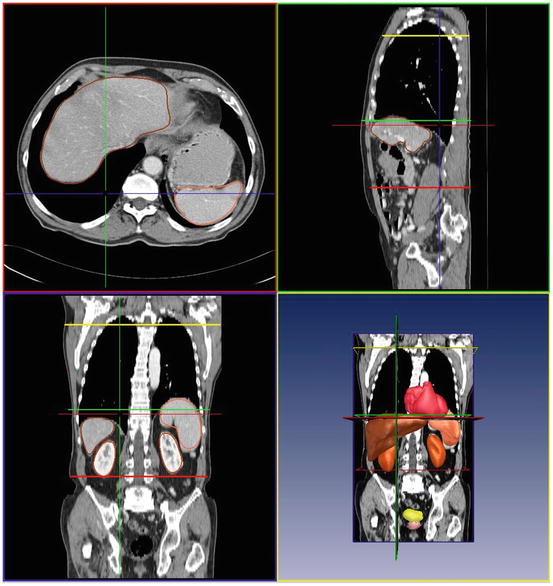 Applications of Marginal Space Learning in Medical Imaging | Radiology Key